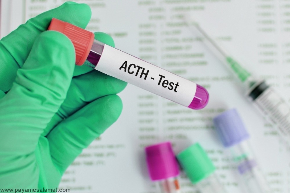 کمبود ACTH ؛ از نشانه ها و علل تا روش های درمان